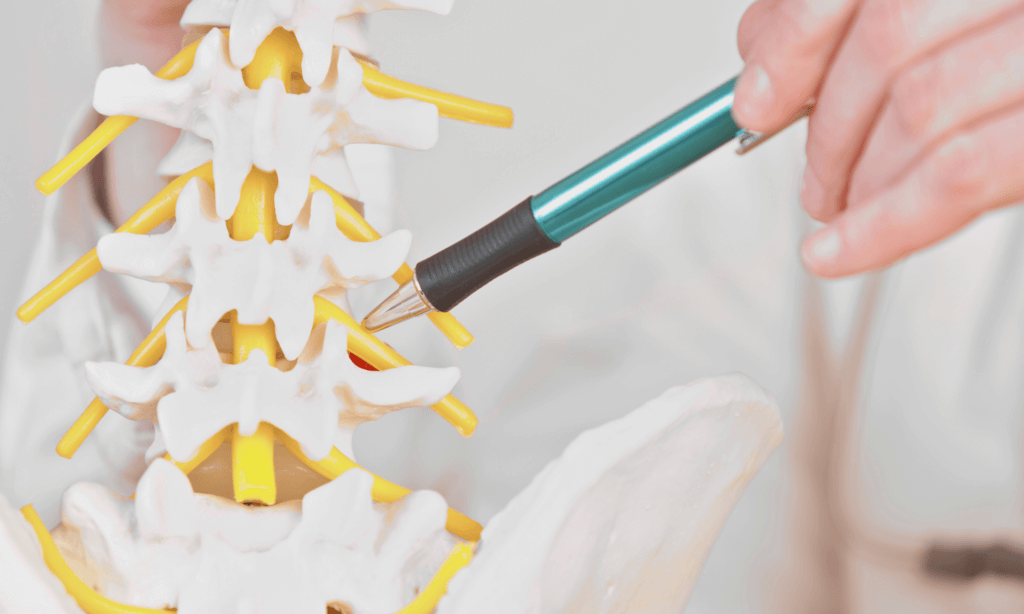 Spondylarthrose nachhaltig lindern • Trautmann Bewegungssysteme